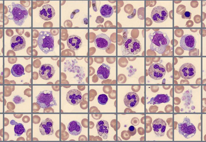 CellaVision Global Test | CellaVision