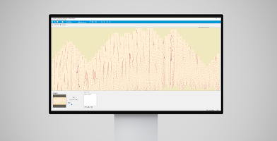Bone Marrow Application | CellaVision