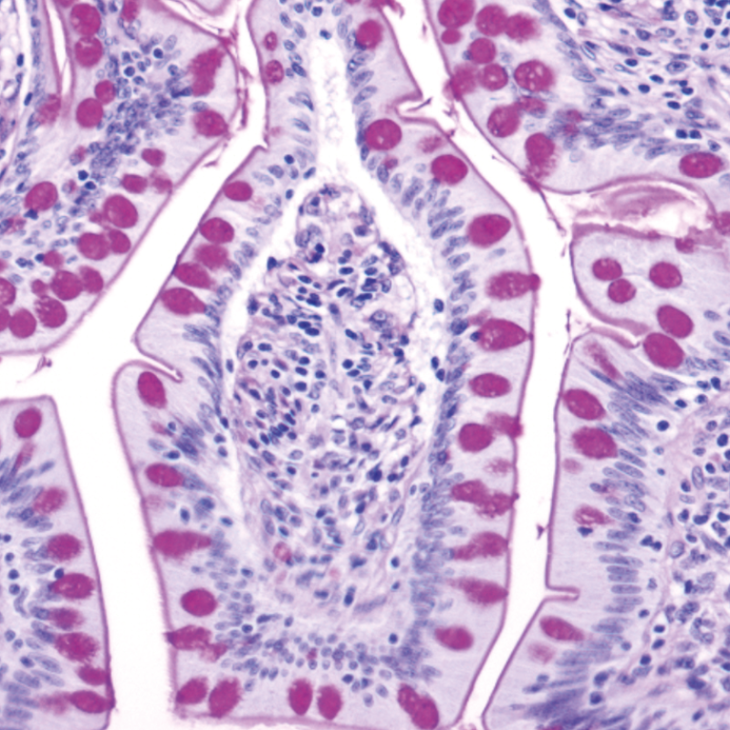 P.A.S. Staining | CellaVision