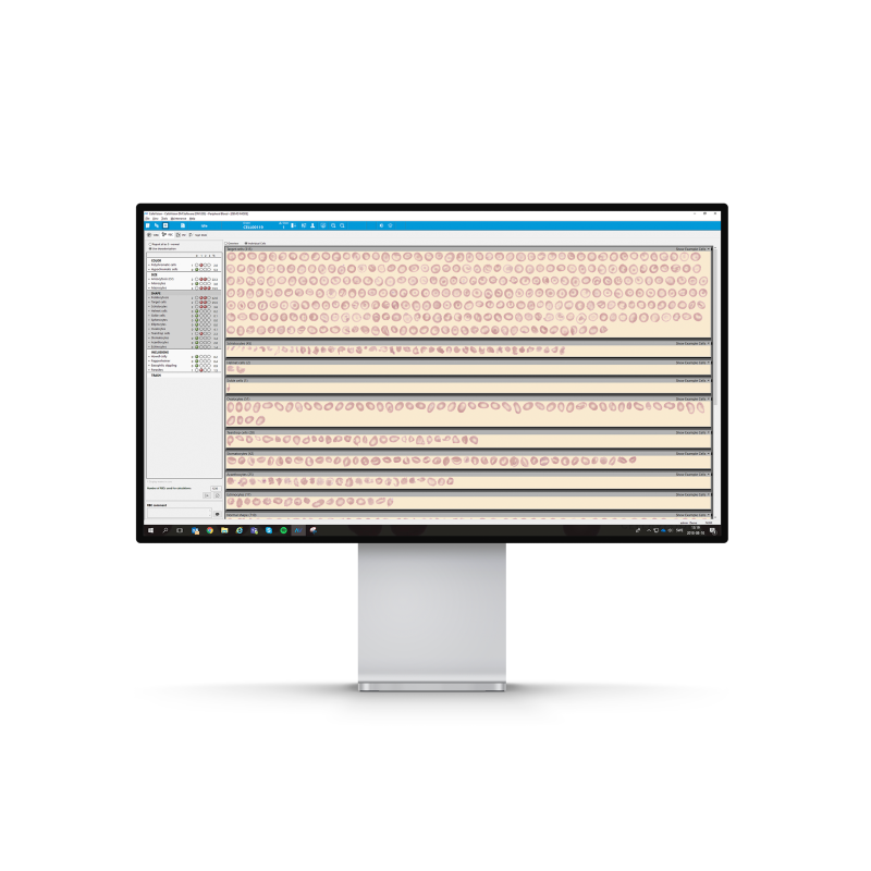 CellaVision® Advanced RBC Application | CellaVision