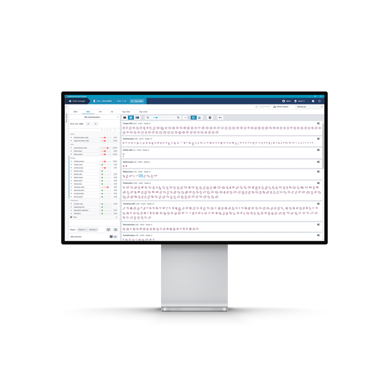 CellaVision® Advanced RBC Application | CellaVision